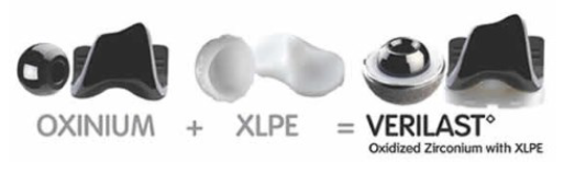 Hip Replacement: The POLARSTEM & R3 Acetabular Cup – A New Design for ...