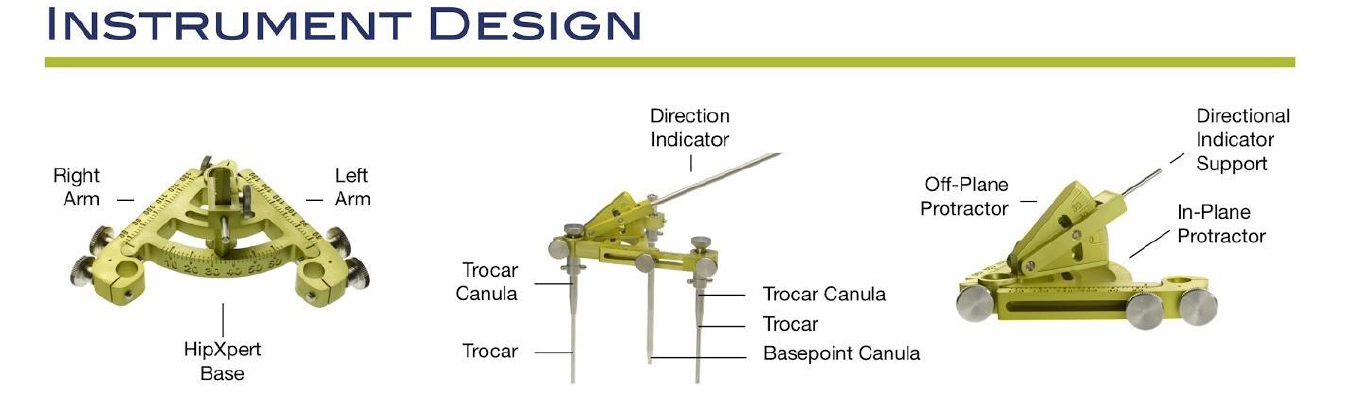 Computer Navigation Total Hip Arthroplasty - The Hip "Xpert"