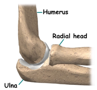 Elbow Fracture: Olecranon, Radial Head, Distal Humerus